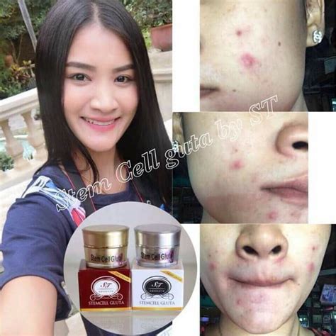 🔹stem Cell Gluta🔹ครีมดี ครีม Stem Cell Gluta By St