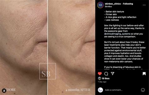 Referral Rebate Clinical Imaging Australia