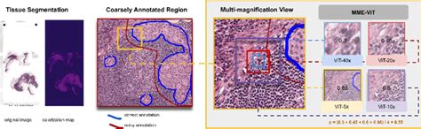 Robust Tumor Detection By Averaging Over Predictions From Vision Download Scientific Diagram