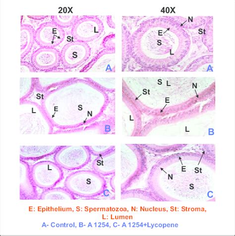 Light Micrographs Of Caput Epididymis Of Control And Experimental