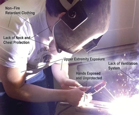Effect Of Welding Radiation Uvr On The Eye And Skin Hsewatch