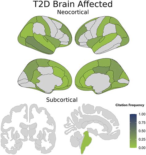 Posterior Cortical Atrophy