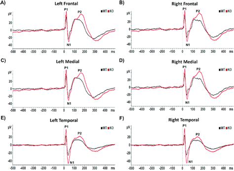 multielectrode array analysis of auditory event related potentials