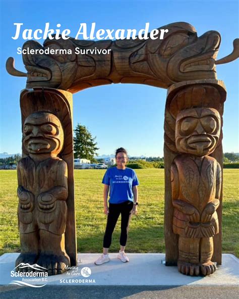 Scleroderma Association Scleroderma Association Of B C