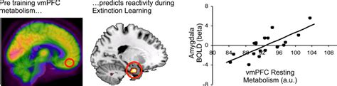 Resting Pre Training Ventromedial Prefrontal Cortex Metabolism Predicts Download Scientific