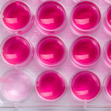 Upstream Bioprocessing Archives