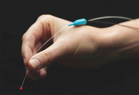 Aussie Firm Reveals Next Gen Migs Device In Pipeline Insight