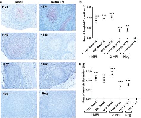 Detection And Quantification Of Cwd Prions In Fixed Paraffin Embedded Tissues By Real Time