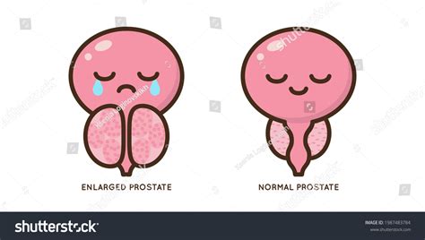 Cartoon Benign Prostate Vector Illustration Icon Stock Vector Royalty