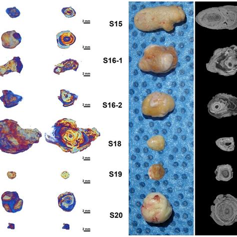 Representative Clinical 2d Micro Ct Cross Section And 3d
