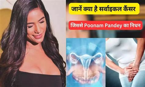 एक्ट्रेस पूनम पांडेय की जिस सर्वाइकल कैंसर से हुई मौत जानिए कैसे होता