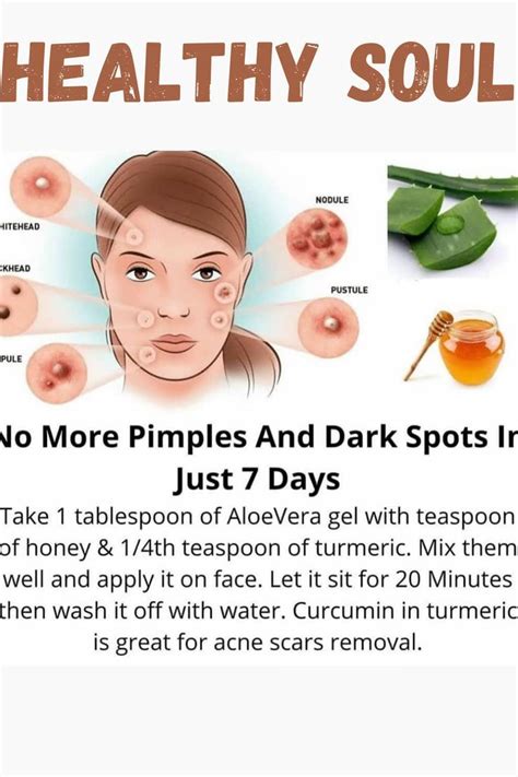 How To Remove Pimples And Dark Spots In Just 7 Days In 2025 How To Remove Pimples Diy Skin