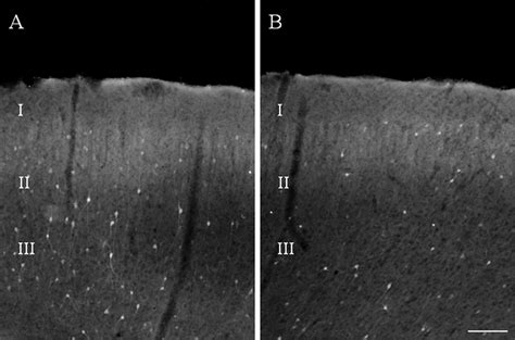 Calbindin D28k Immunofluorescence Staining On Representative Mpfc