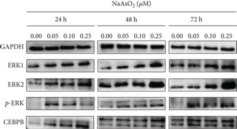 The Erkcebpb Signaling Pathway Participates In Arsenic Induced Skin Download Scientific