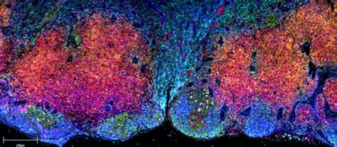 Multiplex Immunofluorescence Mif Services Multiplex If Service