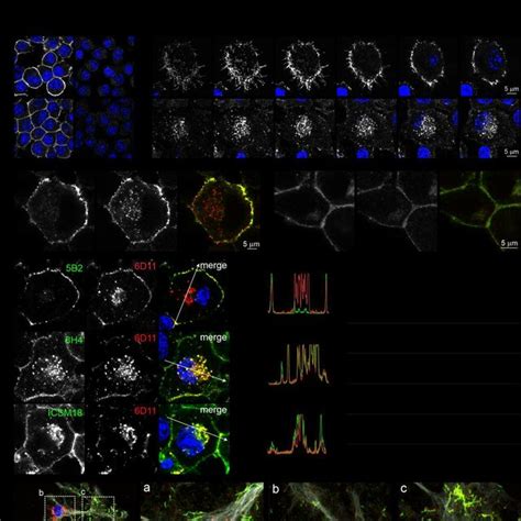 Identification Of Phenotypically Distinct Prp D Aggregates In Download Scientific Diagram