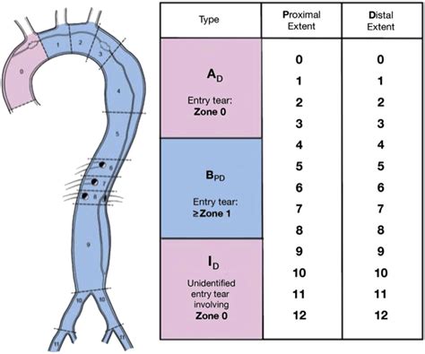 Society For Vascular Surgerysociety Of Thoracic Surgeons Svssts