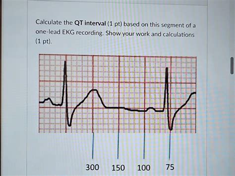 Calculate The Qt Interval 1 Pt Based On This