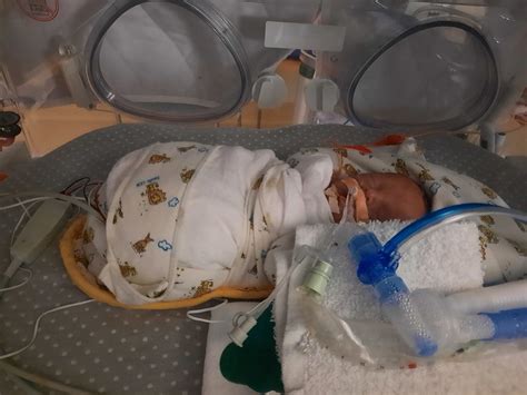 Greely Mom Gives Birth To Triplets On Porch With Help Of Colorado Cops