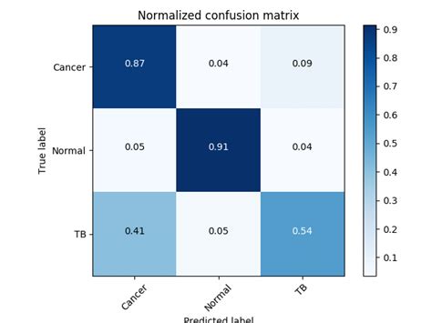 Roc Curve Of Binary Situations Of Abnormal Tbcancer Class 1 And