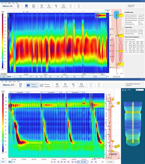 Laboratory Based Manometry At Amy Kates Blog
