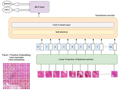 Details Of Vision Transformer Model For Oral Cancer Detection Download Scientific Diagram