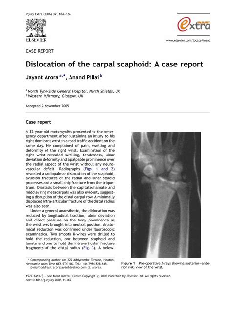 Pdf Dislocation Of The Carpal Scaphoid A Case Report Dokumen Tips
