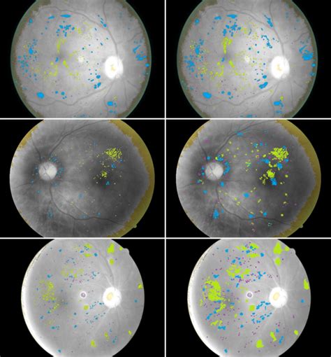 outputs for segmentation of dr lesions ground truth left side and