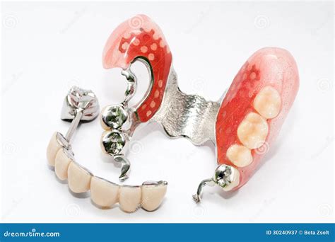 Dental Prosthesis Stock Image Image Of Prosthesis Macro 30240937