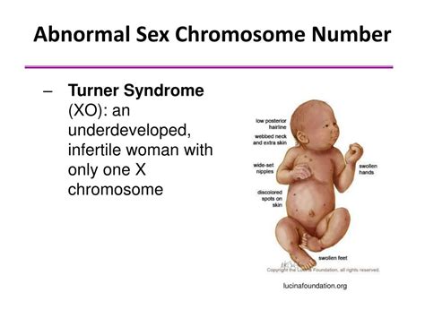 Ppt Chromosomes And Human Inheritance Patterns Of Inheritance