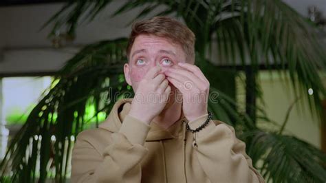 Close Up Of A Young Man With Pimples On His Face The Guy Puts Cream On