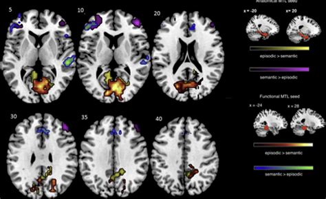The Differences In Episodic And Semantic Memory Teachertoolkit