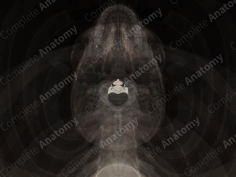 Median Atlantoaxial Joint Complete Anatomy Median Atlantoaxial Joint Complete Anatomy