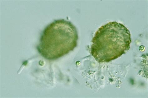 Protist Images Difflugia Pristis