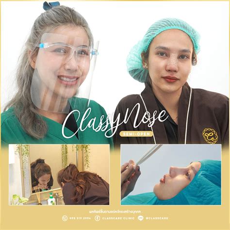 🌤 เคสแก้จมูก Classcare Clinic ทำตาสองชั้น