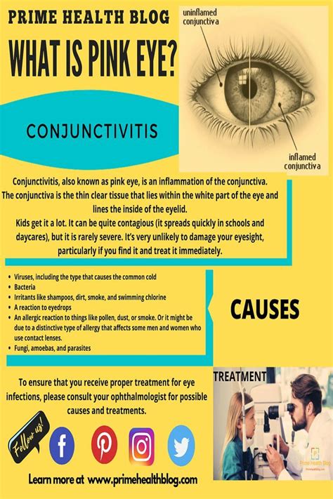 Conjunctivitis Pink Eye Overview Symptoms Causes And Treatments Artofit
