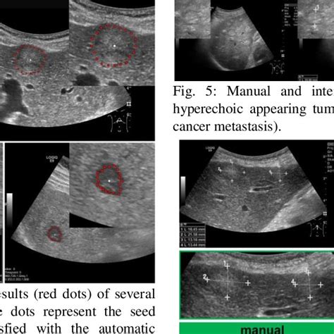 Schematic Overview Of The Different Echo Pattern Of Homogenous Liver Download Scientific