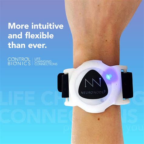 Control Bionics Sund Co