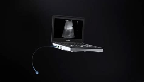 Asset Download Mindray