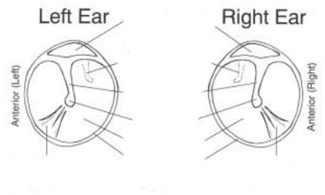 Anatomy Of The Tympanic Membrane Diagram Quizlet