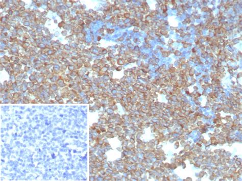 Recombinant Cd74 B Cell Marker Transcription Regulator Antibody