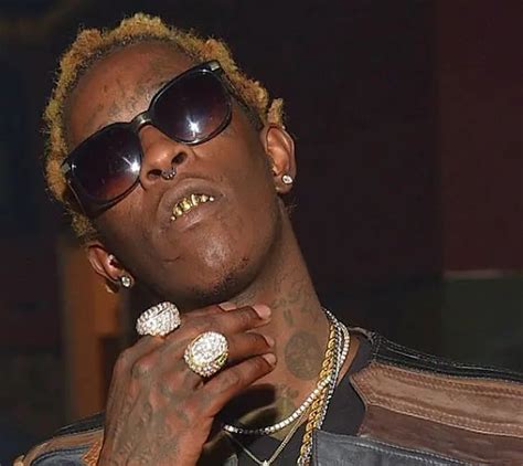 Denti Di Young Thug Vecchi Nuovi Prima E Dopo Lema Dental Clinic