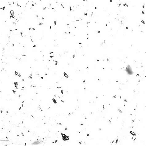 Automated Particle Size Count Analysis At Best Price In Pune