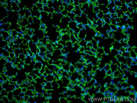 Integrin Alpha 8 Antibody 30714 1 Ap Proteintech
