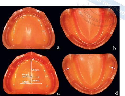 Figure 1 From Accuracy Of Intraoral Scanning Of Edentulous Jaws With
