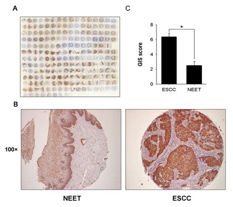 Tissue Microarray Analysis Of Galectin 7 Expression A Overview Of