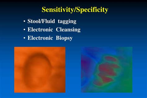 Ppt Advancing Virtual Colonoscopy To Practice Powerpoint Presentation