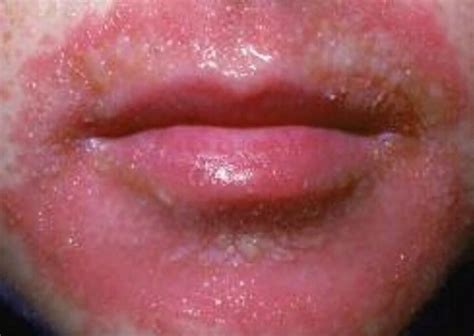 Trøbbel Etter Sex Kan Være Farlig