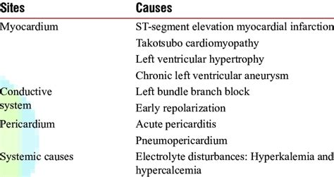 Causes Of St Segment Elevation Download Scientific Diagram