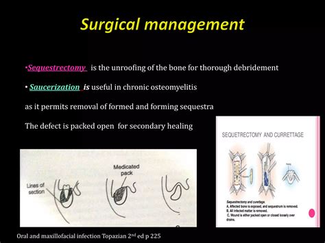 Osteomyelitis In Maxillofacial Region Pdf
